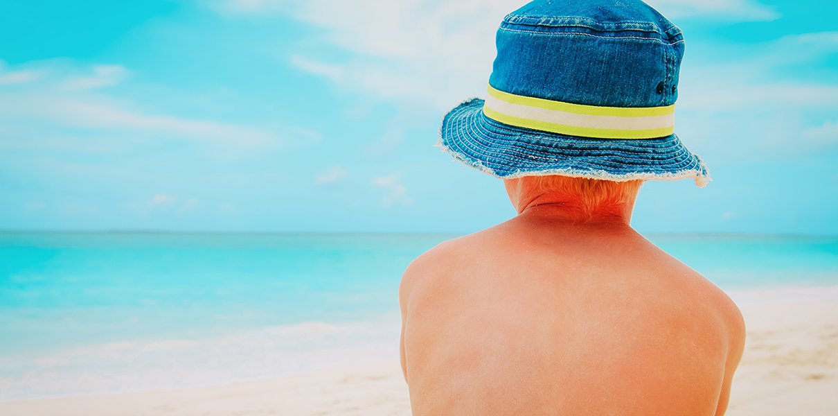 Как понять, что у ребёнка аллергия на солнце? | Мел